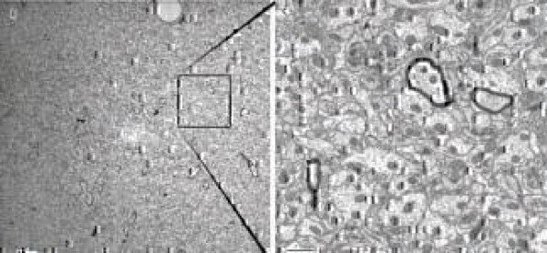 New Opportunities in the Nanoscopic Analysis of Large-area Samples ...