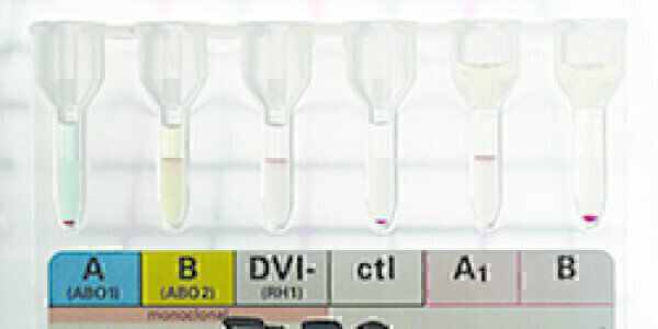 Convenient and Accurate Ready-to-Use Cell Suspensions for Column ...