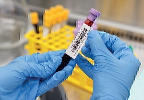 Are your sample identification labels reliable? Labmate Online