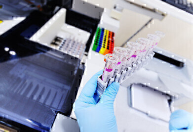 Rapid COVID-19 Diagnostic Infection Testing Labmate Online