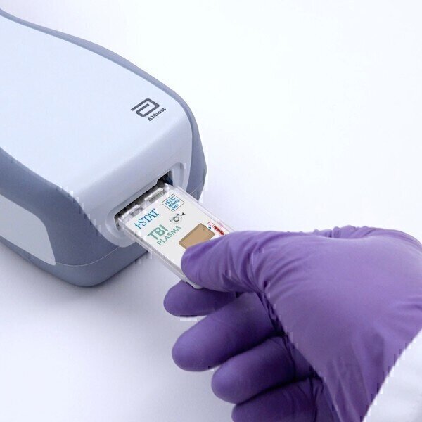 Brain Injury Test Achieves CE Mark Labmate Online