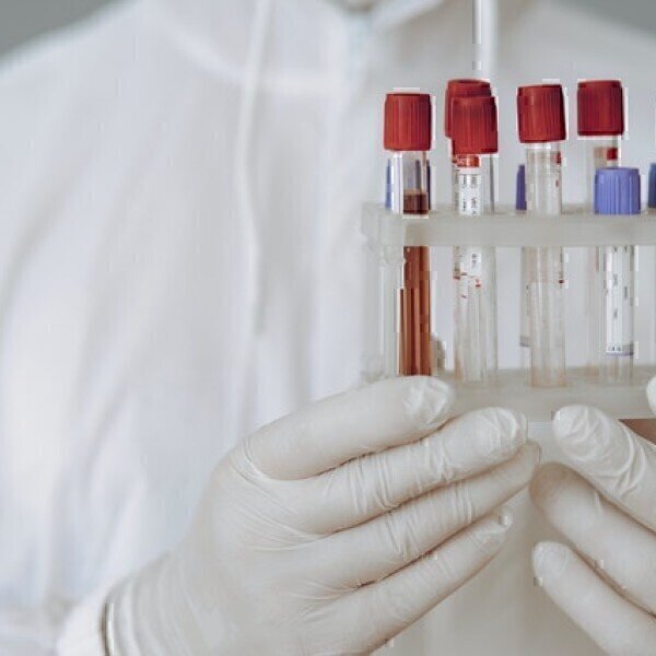 What's the Right Temperature for Transporting Samples? Labmate Online