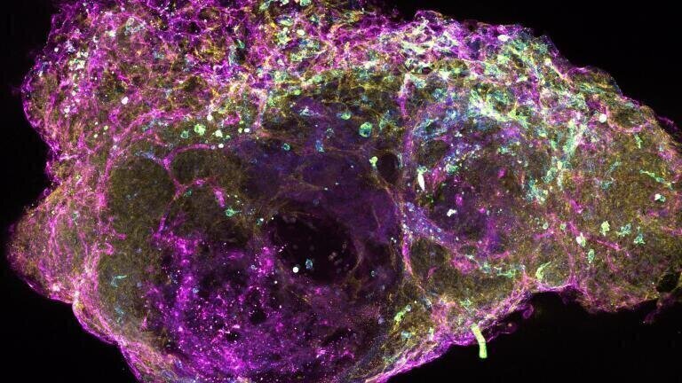 Bone Marrow technology set to improve Anti-Cancer Therapies Labmate Online