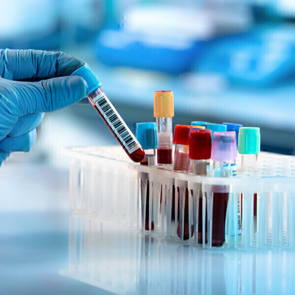 Heranova unveils revolutionary non-invasive endometriosis test ...