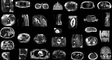 Artificial intelligence model automatically segments MRI scans Labmate ...