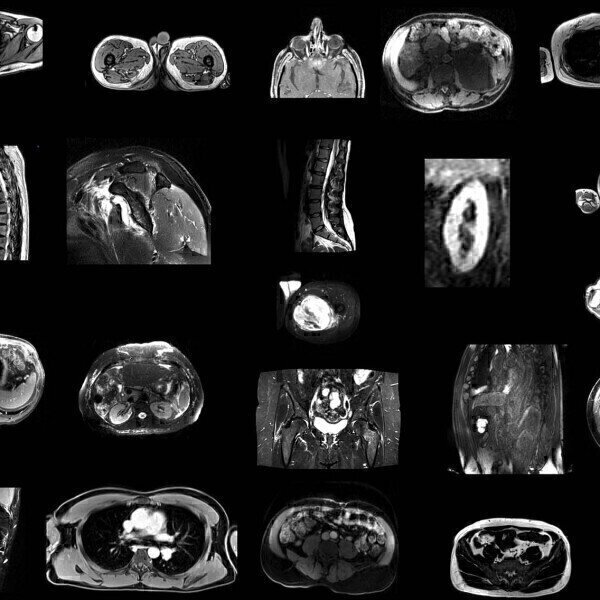 Artificial intelligence model automatically segments MRI scans Labmate ...