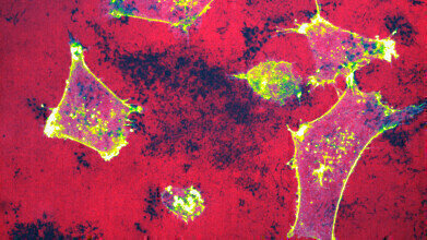 Visual breakthrough targets breast cancer spread Labmate Online