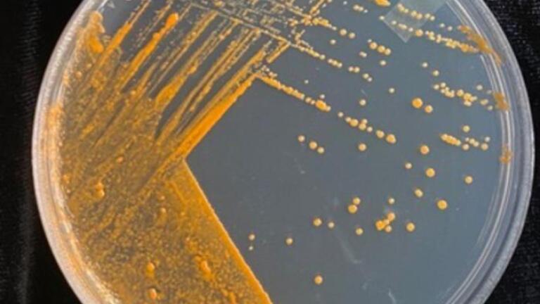 Grape vine bacteria found to neutralise smoke taint in wildfire-exposed ...