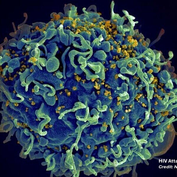 Chemotherapy-linked action on HIV-infected T cell clones points to ...