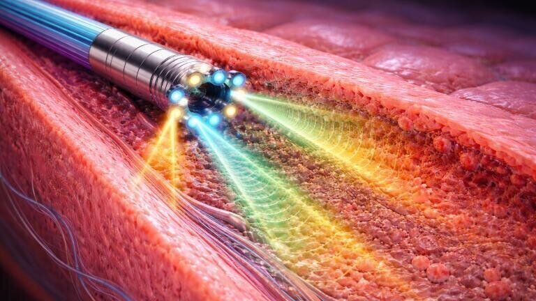 Miniature fibre probe extends optical coherence tomography imaging ...