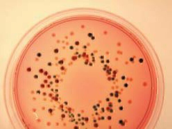 Integral Supplement to E. coli O157 Isolation Labmate Online
