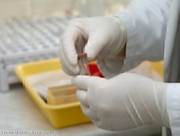 Breakthrough Capillary Flow Technology Reliably Manipulates Flow Inside ...